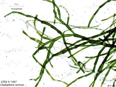 Cladophora Microscope Labeled